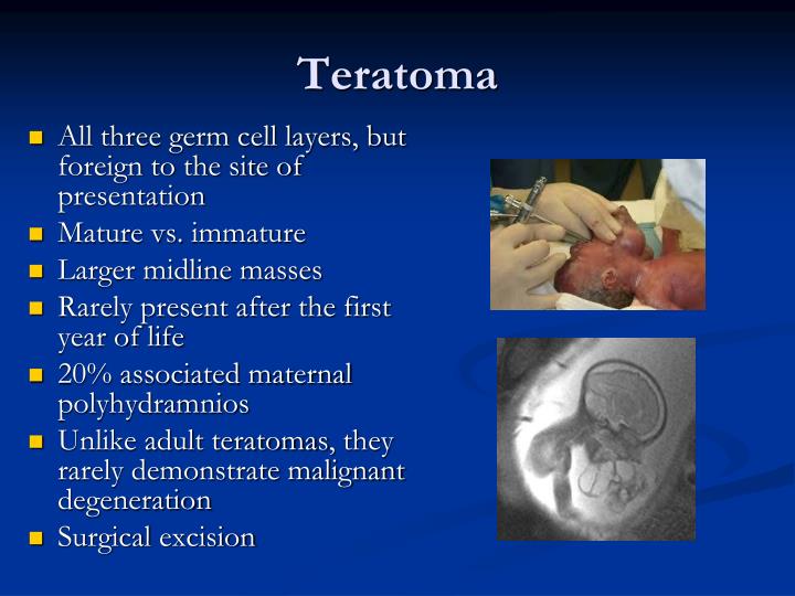 PPT - Head & Neck Masses including Salivary Glands PowerPoint ...