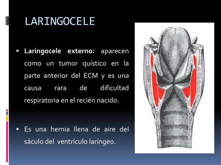 PPT - TUMORES Y QUISTES CONGÉNITOS DEL CUELLO PowerPoint Presentation ...
