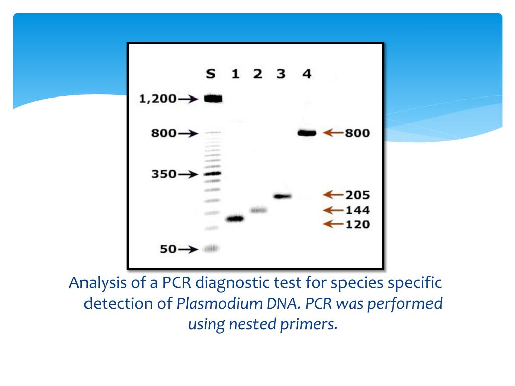 PPT - MALARIA, ROLE OF SEROLOGY: ELISA AND PCR PowerPoint Presentation ...
