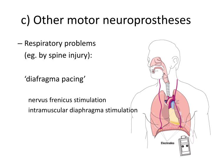 PPT - Neuroplasticity PowerPoint Presentation - ID:2128633