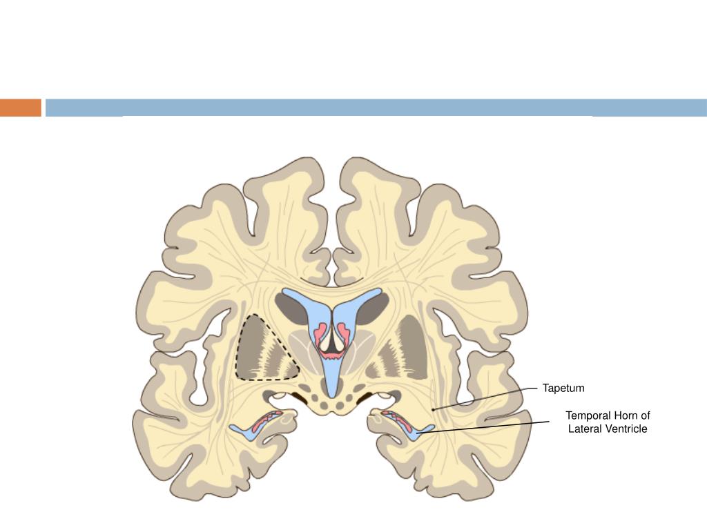 PPT - Anatomy of the Cerebral Ventricles PowerPoint Presentation, free ...