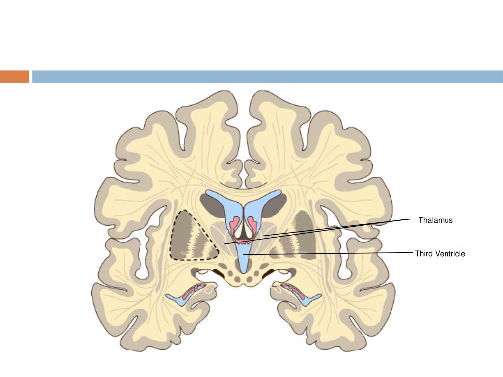 PPT - Anatomy of the Cerebral Ventricles PowerPoint Presentation, free ...