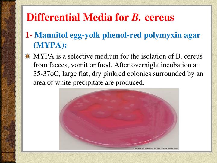 PPT - Identification Of Gram Positive Bacilli PowerPoint Presentation ...