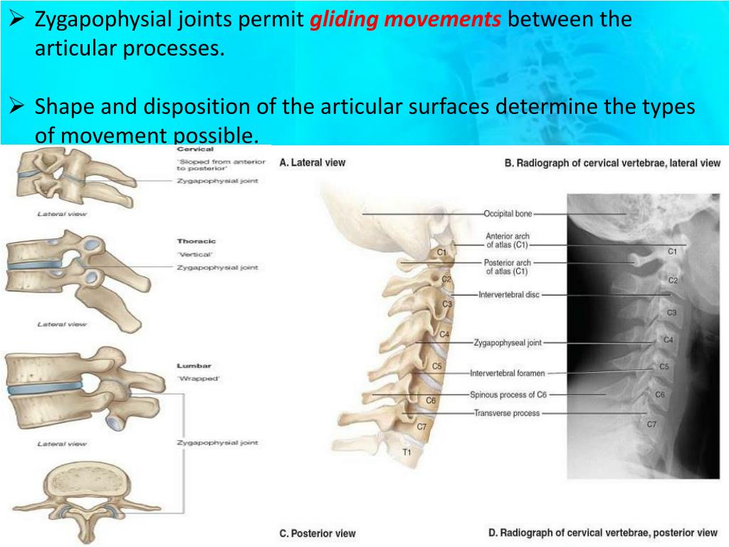 PPT - Joints of the vertebral bodies Joints of the vertebral arches ...