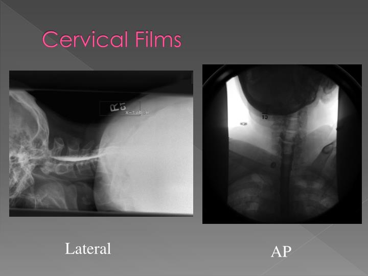 PPT - Myelography PowerPoint Presentation - ID:2131458