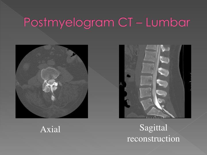 PPT - Myelography PowerPoint Presentation - ID:2131458