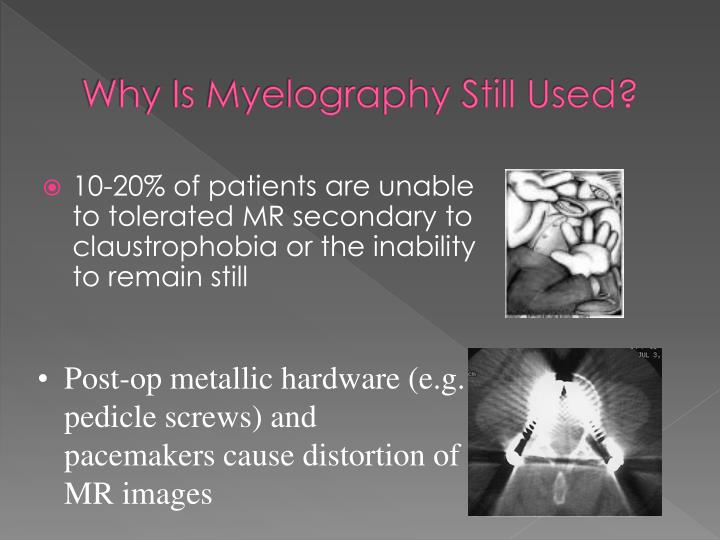 PPT - Myelography PowerPoint Presentation - ID:2131458