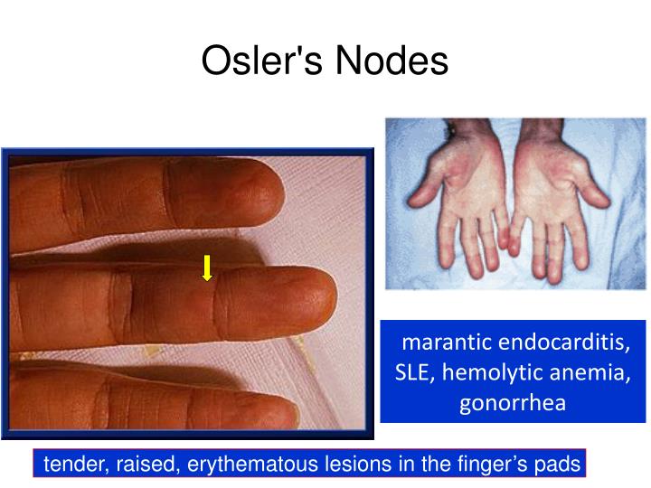 PPT - מקרה 1 PowerPoint Presentation - ID:2131713