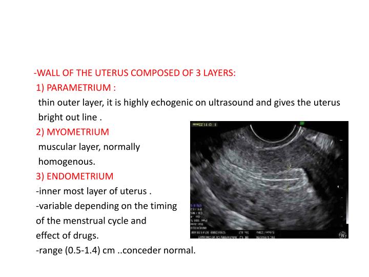 PPT - Pelvic Ultrasound PowerPoint Presentation - ID:2132352