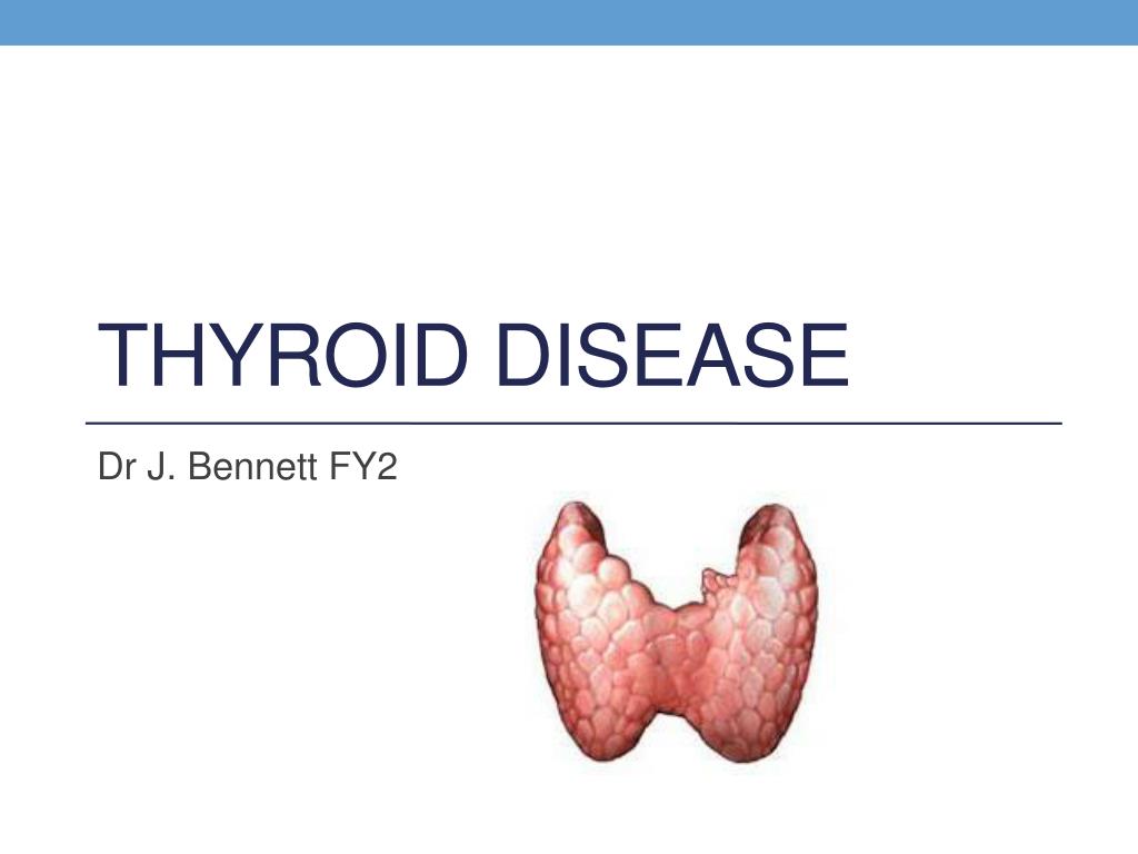 Ppt Thyroid Disease Powerpoint Presentation Free Download Id 2132906
