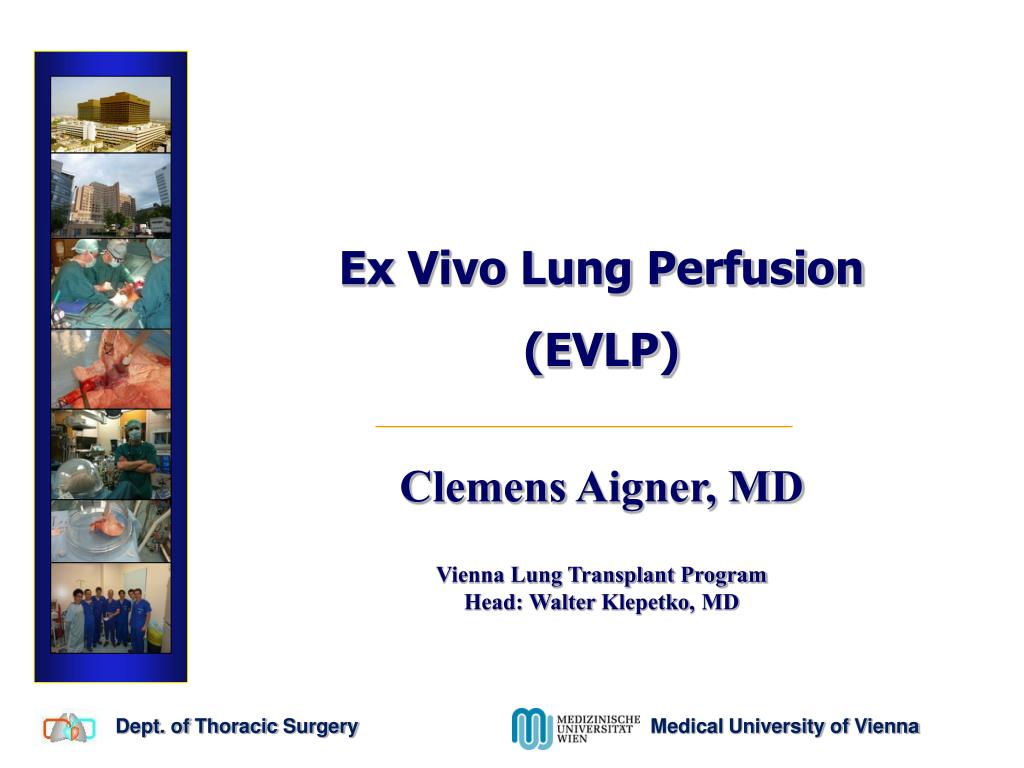 PPT - Ex Vivo Lung Perfusion (EVLP) Clemens Aigner , MD Vienna Lung ...