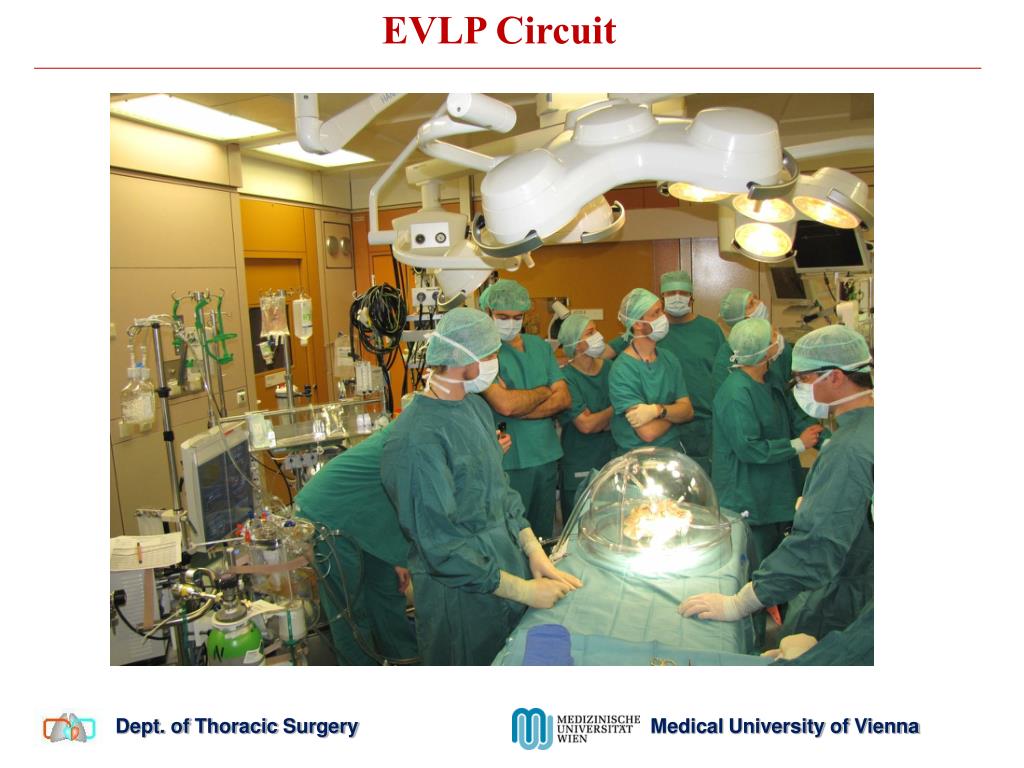 PPT - Ex Vivo Lung Perfusion (EVLP) Clemens Aigner , MD Vienna Lung ...