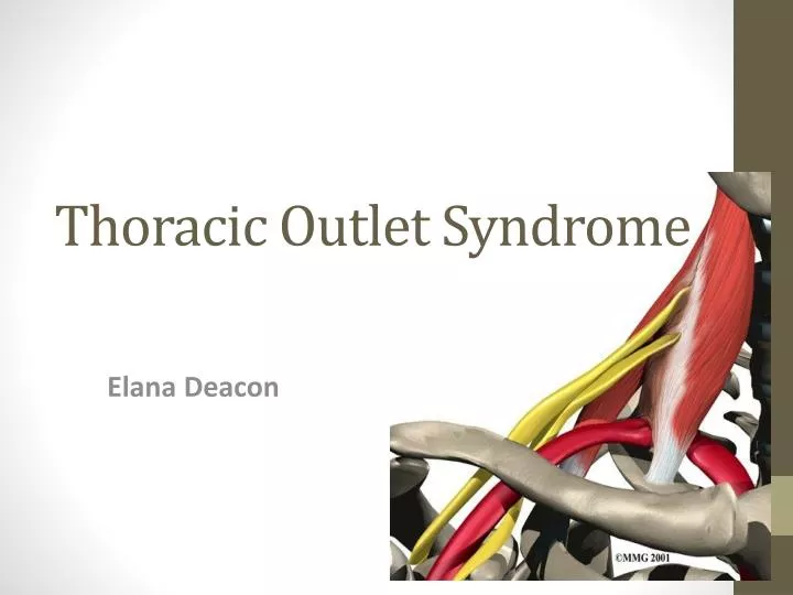 PPT - Thoracic Outlet Syndrome PowerPoint Presentation, free download ...