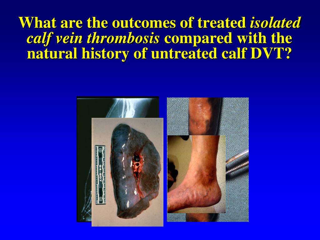 PPT - Research Priorities in Venous Disease PowerPoint Presentation ...