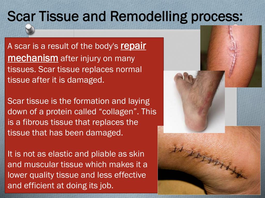 PPT - The Physiological and Psychological responses to sports injuries ...