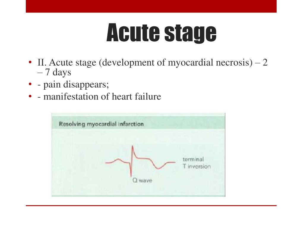PPT - Main symptoms and syndromes in ischemic heart disease PowerPoint ...