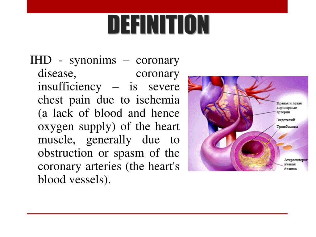 PPT - Main symptoms and syndromes in ischemic heart disease PowerPoint ...