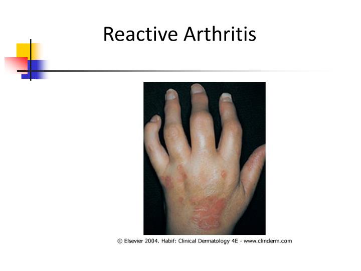 PPT - SKIN MANIFESTATIONS IN RHEUMATIC DISEASES AROMA 2011 PowerPoint ...