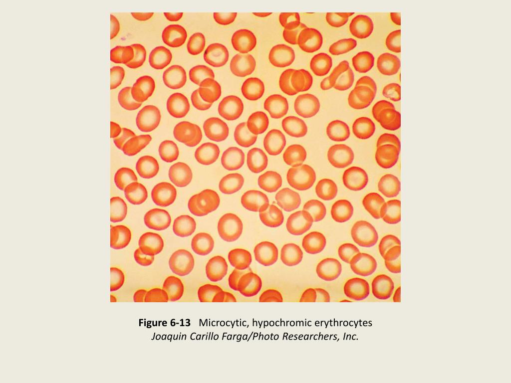 PPT - Ch. 6 Hematology and Immunology PowerPoint Presentation, free ...