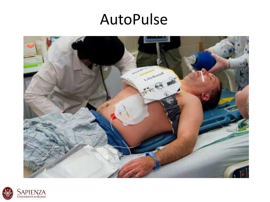 PPT - Mechanical devices for cardiac massage: must-have or luxury ...