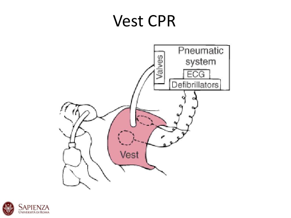 PPT - Mechanical devices for cardiac massage: must-have or luxury ...