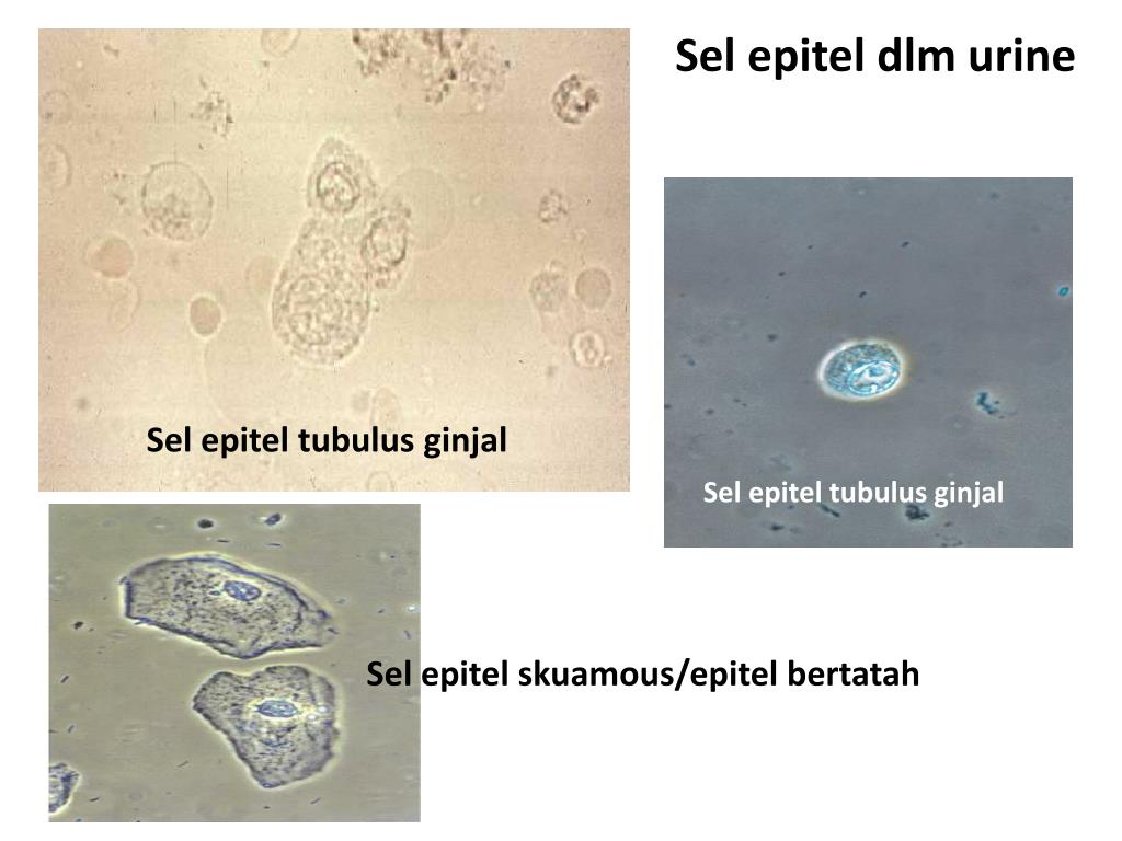 PPT - Patologi Klinik FKU-UWKS PRAKTIKUM URINALISIS PowerPoint ...
