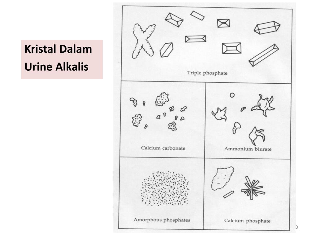 PPT - Patologi Klinik FKU-UWKS PRAKTIKUM URINALISIS PowerPoint ...