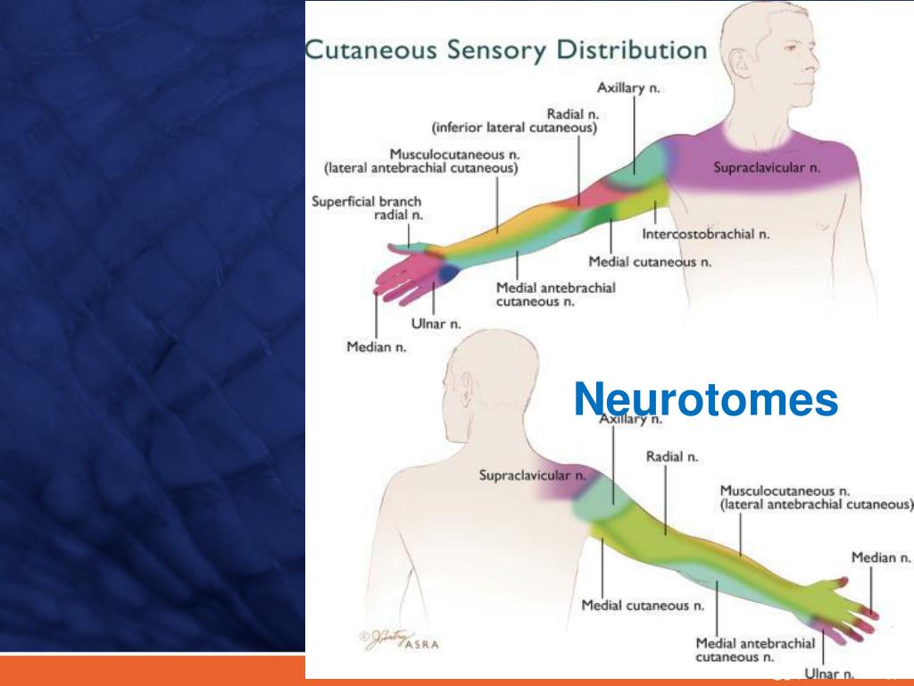 PPT - Anestesia Regional Barys Ihnasenka , and Kiki Nin 4/27/2013 ...