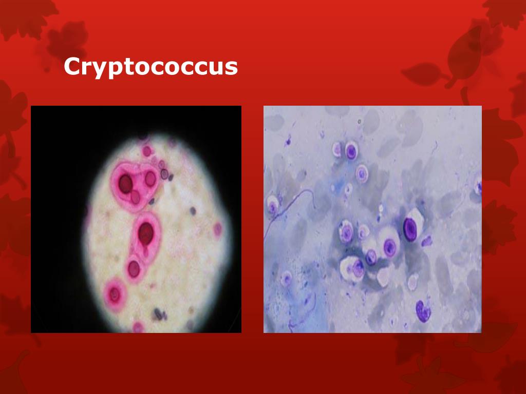 PPT - Clin Med II Infectious Disease PowerPoint Presentation, free ...