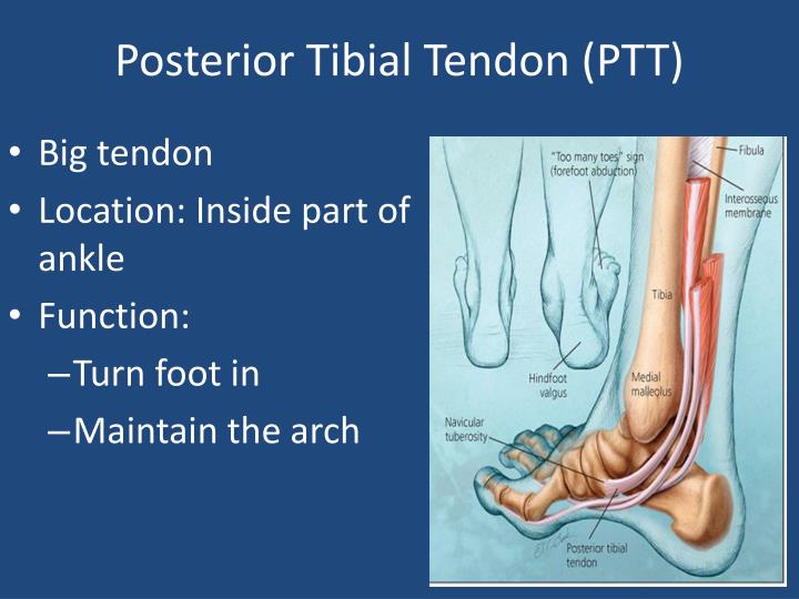 PPT - My Ankle…Posterior Tibial Tendon Insufficiency PowerPoint ...
