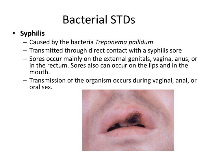 PPT - STDs and Contraceptives PowerPoint Presentation - ID:2140366