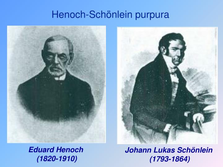 PPT - Henoch-Schonlein purpura PowerPoint Presentation - ID:2142942