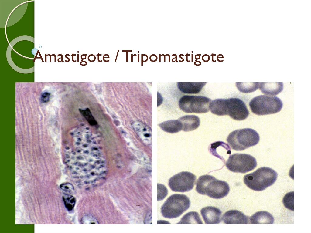 PPT - Trypanosoma cruzi (Enfermedad de Chagas) PowerPoint Presentation ...