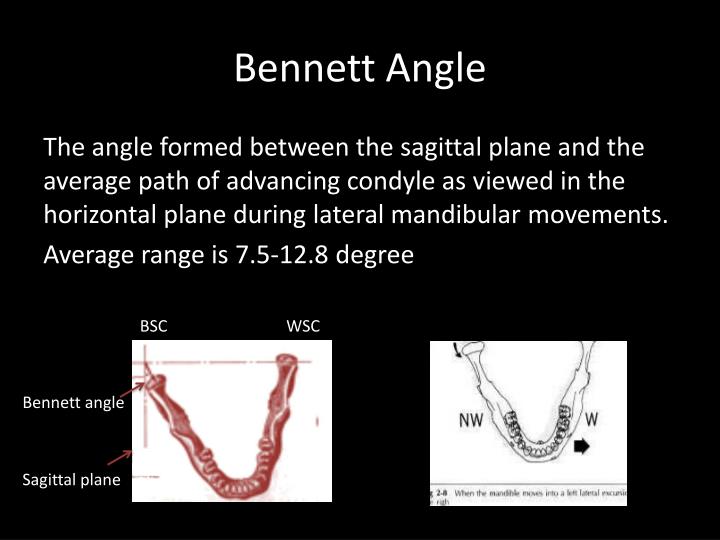 PPT - Fundamentals Of Occlusion PowerPoint Presentation - ID:2143561