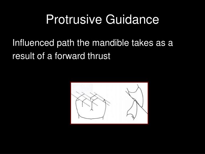 PPT - Fundamentals Of Occlusion PowerPoint Presentation - ID:2143561