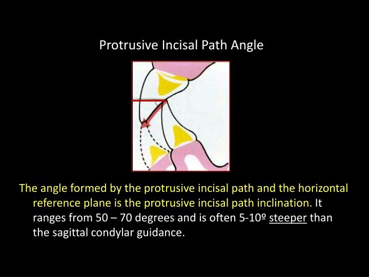 PPT - Fundamentals Of Occlusion PowerPoint Presentation - ID:2143561