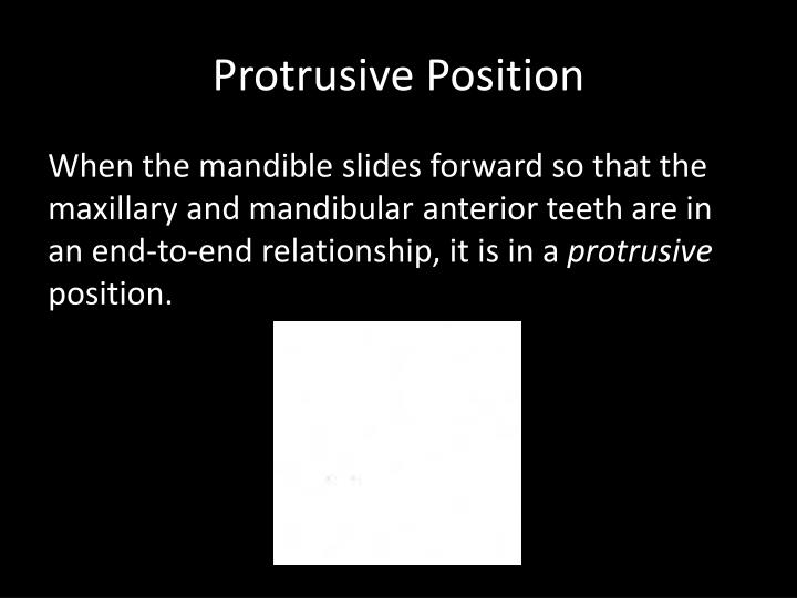 PPT - Fundamentals Of Occlusion PowerPoint Presentation - ID:2143561