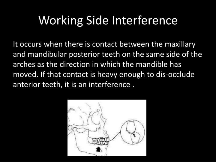 PPT - Fundamentals Of Occlusion PowerPoint Presentation - ID:2143561