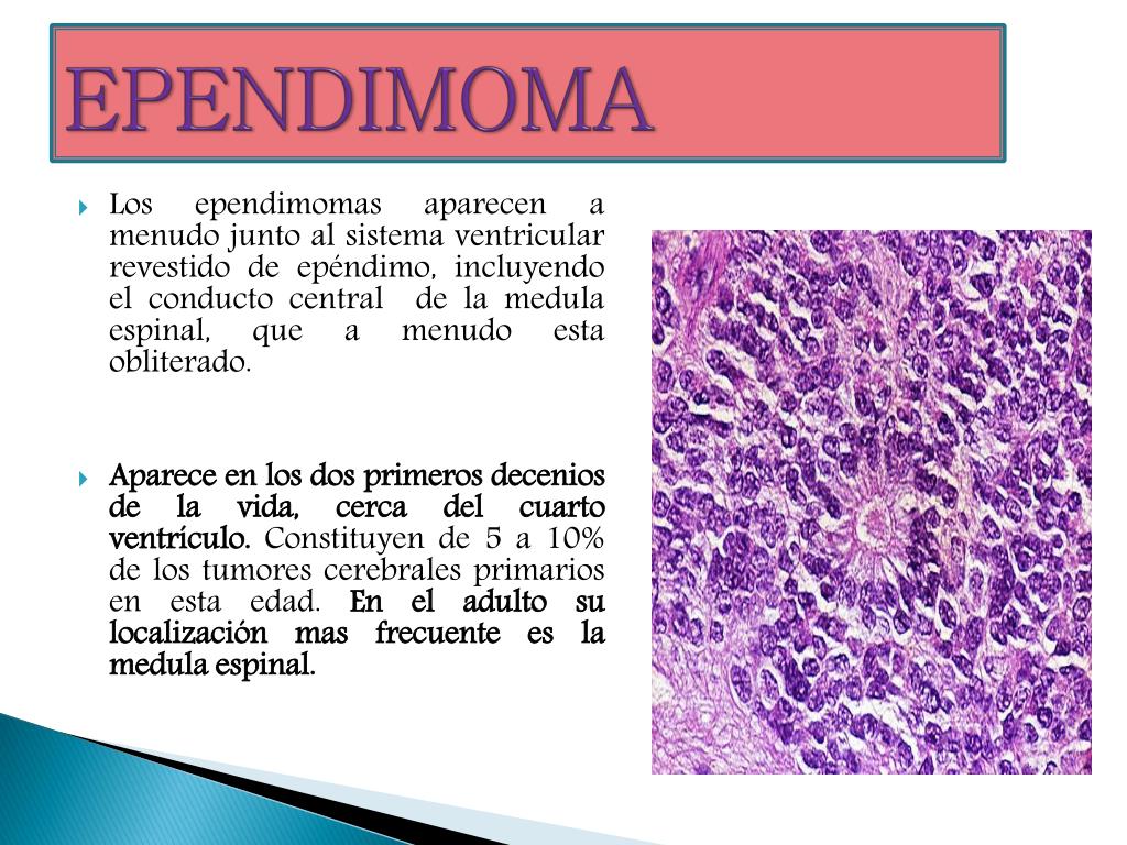 PPT - Patologias del Sistema Nervioso Central PowerPoint Presentation ...