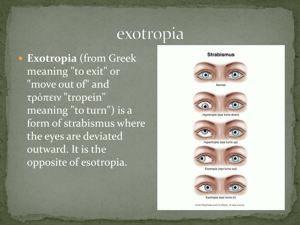 PPT - Eye Signs, Symptoms, and Diseases PowerPoint Presentation, free ...