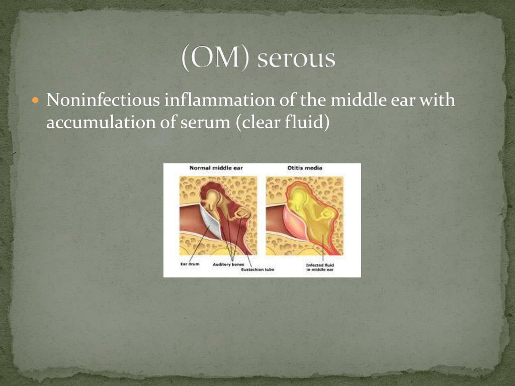 PPT - Eye Signs, Symptoms, and Diseases PowerPoint Presentation, free ...