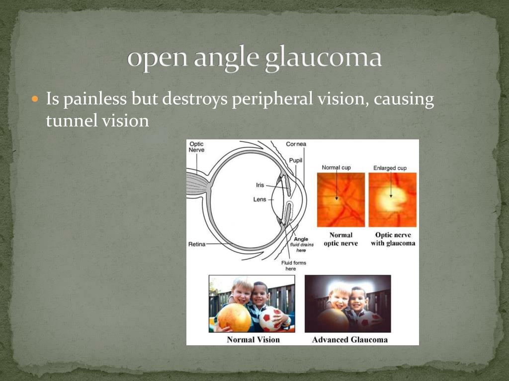 PPT - Eye Signs, Symptoms, and Diseases PowerPoint Presentation, free ...