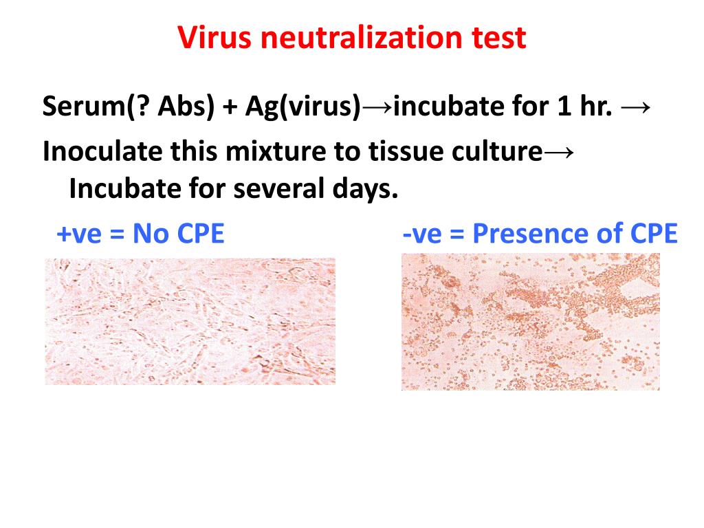 PPT - Immunodiagnosis Antigen antibody reactions PowerPoint ...