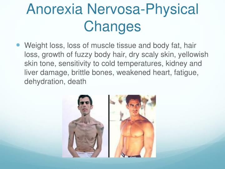 PPT - Eating Disorders & Healthy Body Image PowerPoint Presentation ...