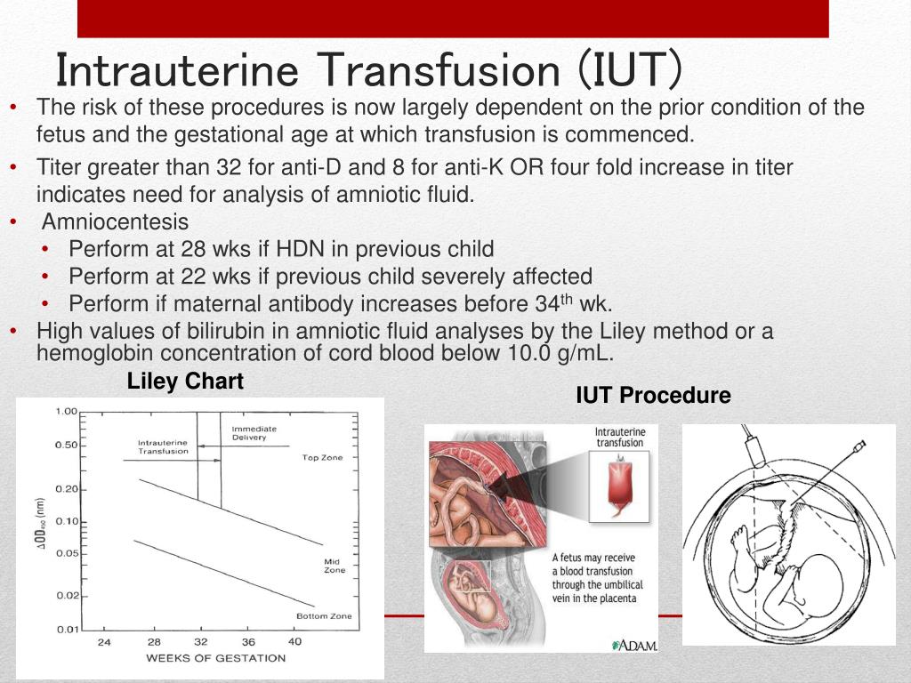 PPT - HEMOLYTIC DISEASE OF NEWBORN (HDN) PowerPoint Presentation, free ...