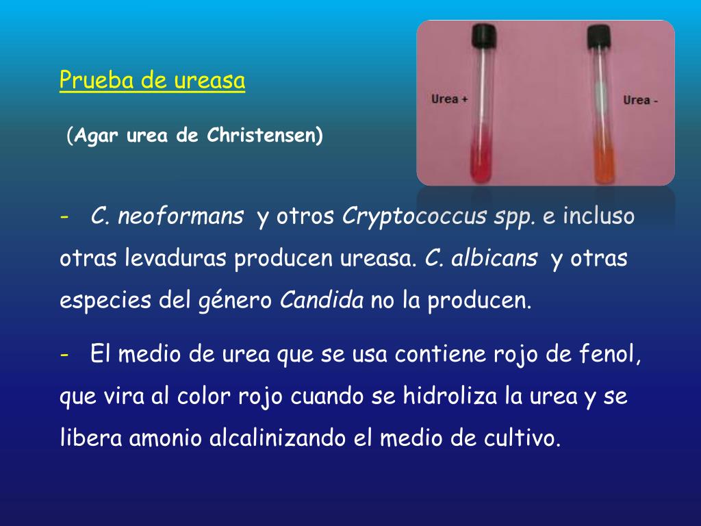 PPT - IDENTIFICACIÓN DE LEVADURAS de interés médico PowerPoint ...