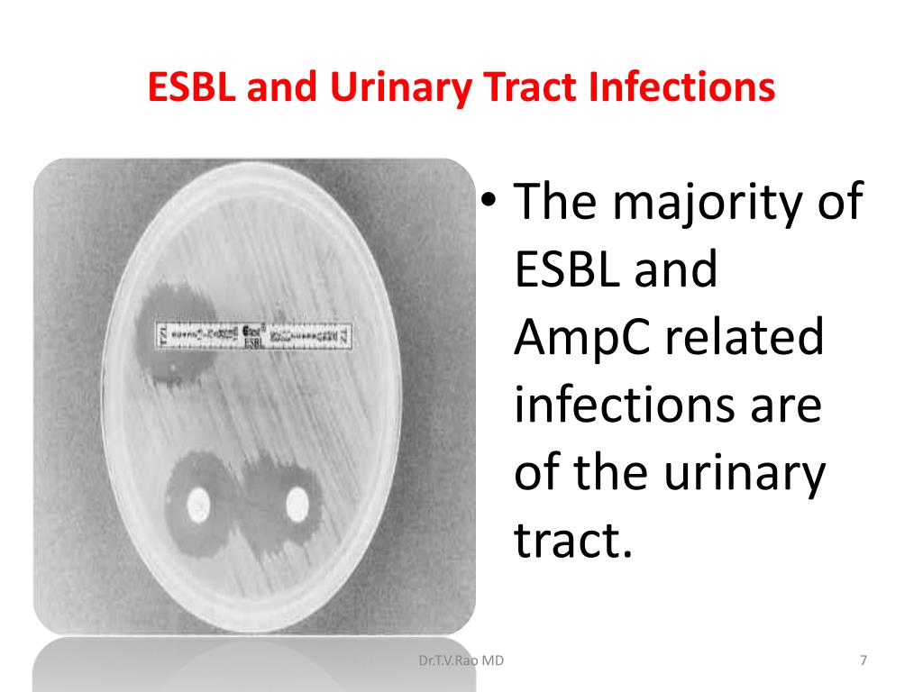 PPT - ESBL PRODUCING BACTERIA Therapeutic Options PowerPoint ...