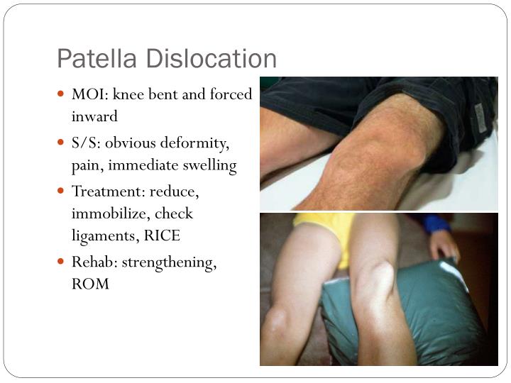 PPT - Ch. 18 Knee Injuries PowerPoint Presentation - ID:2147623