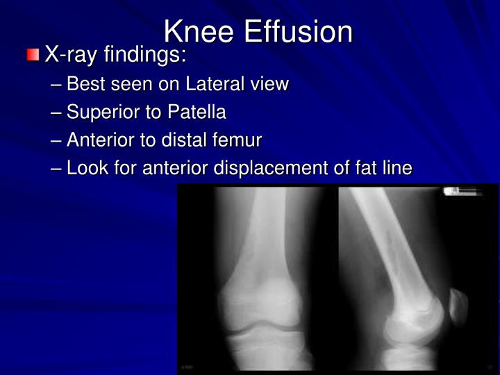 PPT - Lower Extremities PowerPoint Presentation - ID:2148842