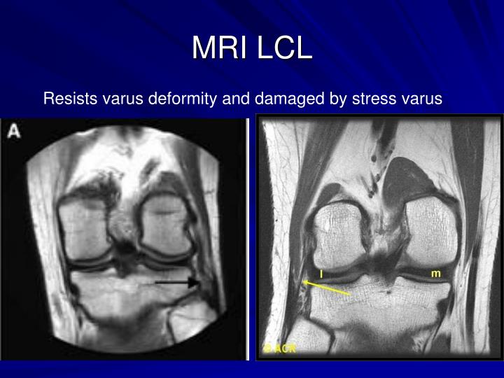 PPT - Lower Extremities PowerPoint Presentation - ID:2148842